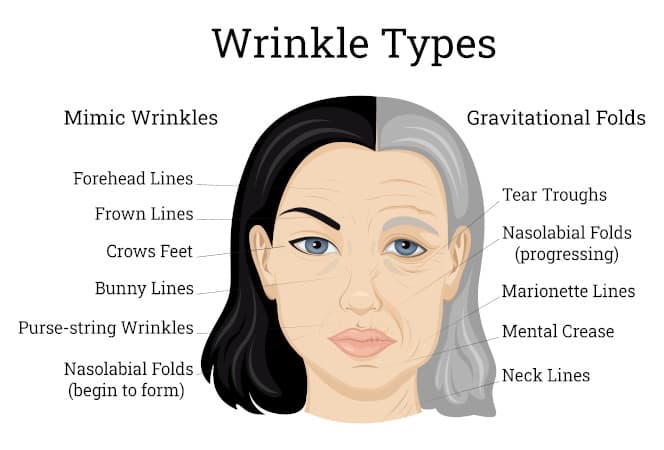 How Many Units Of Botox For Downturned Mouth Cosmetic Surgery Tips